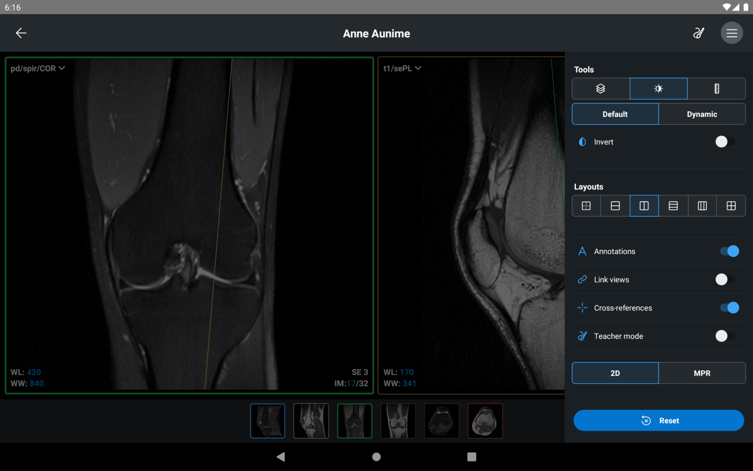 Download IDV - IMAIOS DICOM Viewer APKs for Android - APKMirror