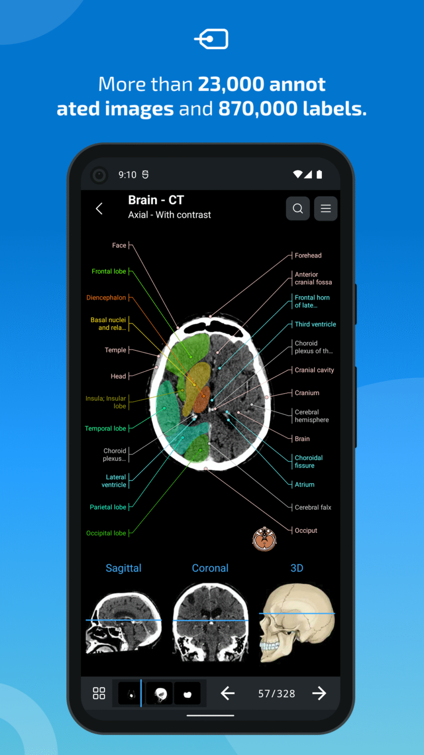 IMAIOS e-Anatomy 7.9.2 (120-640dpi) APK Download by IMAIOS SAS - APKMirror