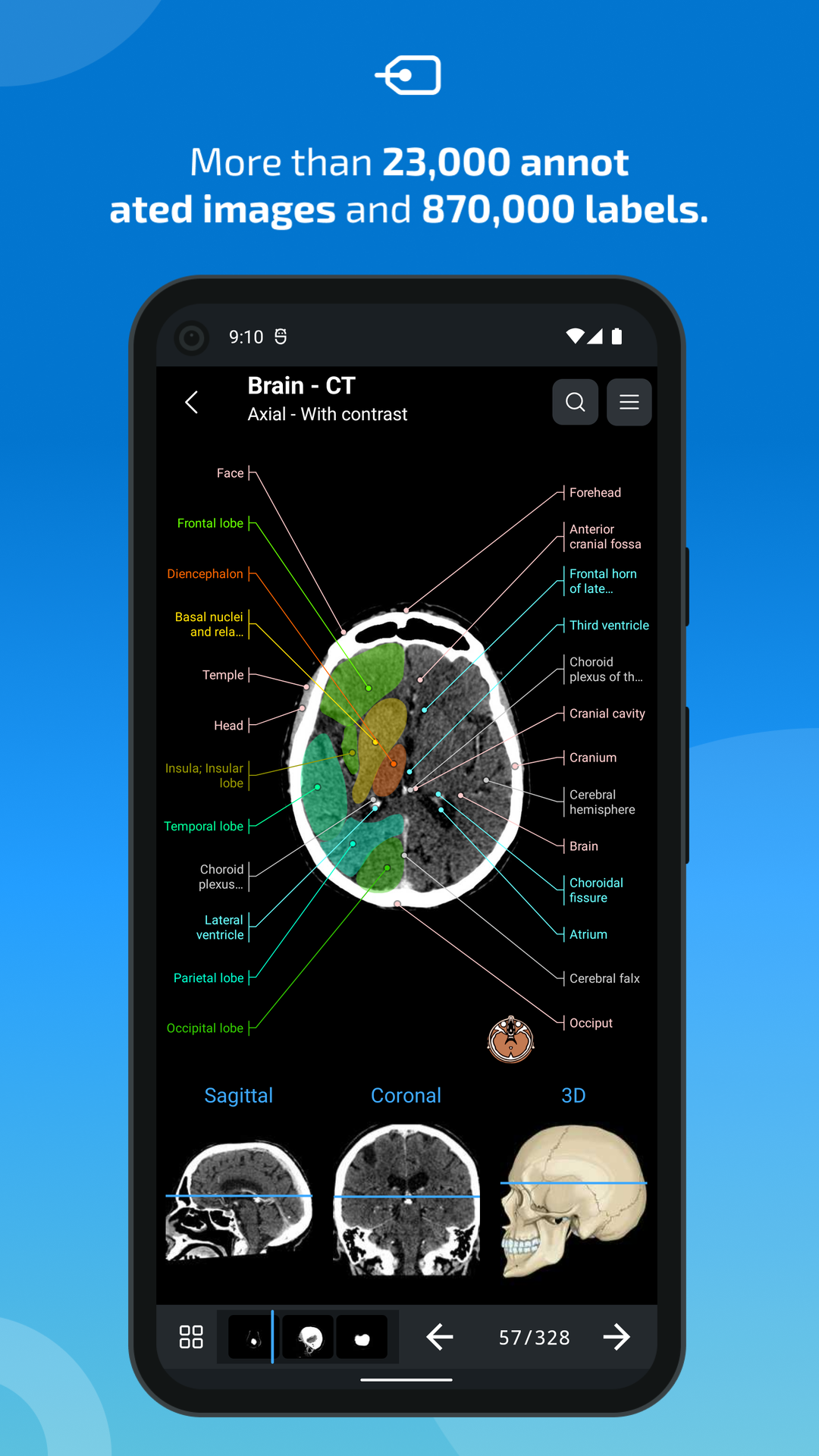 IMAIOS e-Anatomy 7.9.2 APK Download by IMAIOS SAS - APKMirror