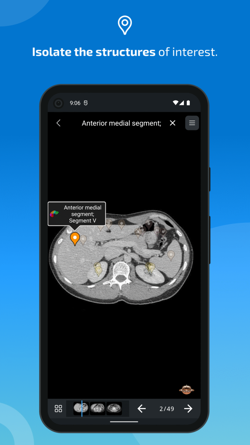 IMAIOS e-Anatomy 7.9.2 APK Download by IMAIOS SAS - APKMirror